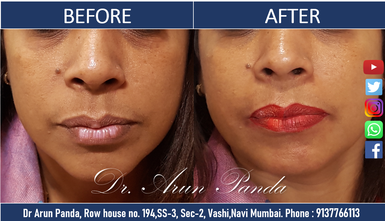 Gallery | Dr Arun Panda