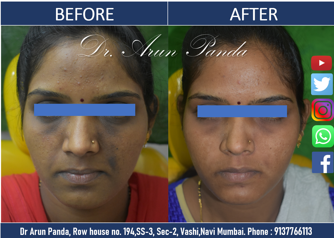 Gallery | Dr Arun Panda