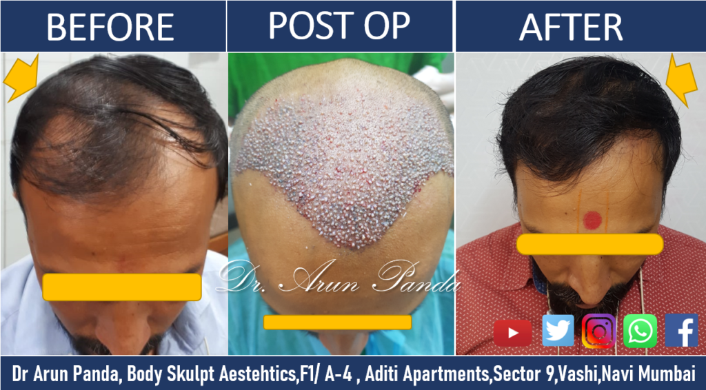- Dr Arun Panda