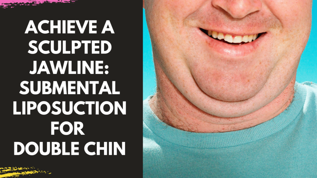 Liposuction for Double Chin removal in Mumbai by Dr Arun Panda