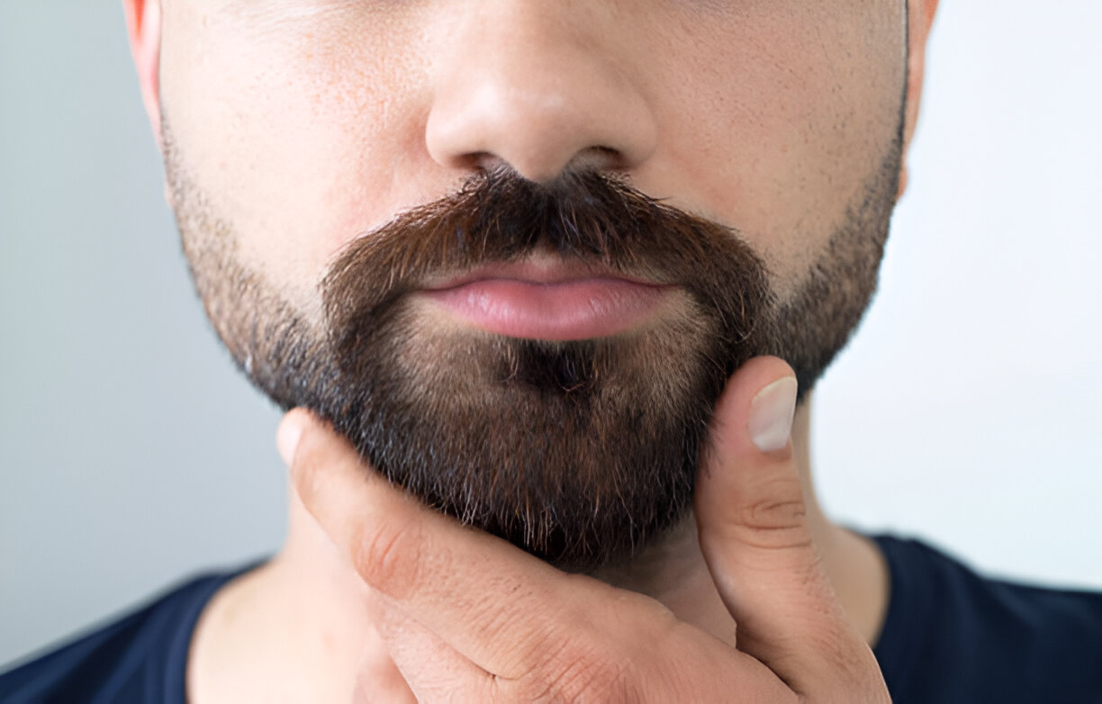Beard Reconstruction in Navi Mumbai – Restore Your Beard at Bodyskulpt ...