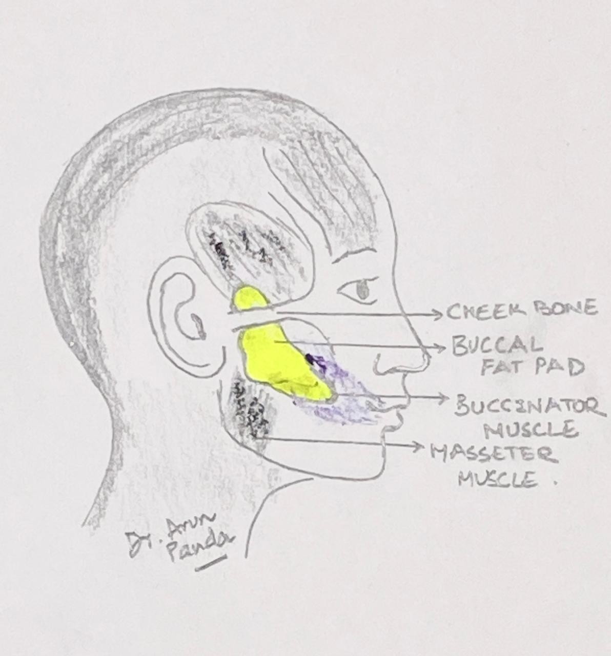 Cost of Buccal Fat Removal: Transform Your Face – Dr Arun Panda